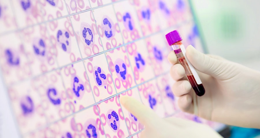 3-part Vs. 5-part Differential Hematology Analyzers | Beckman Coulter