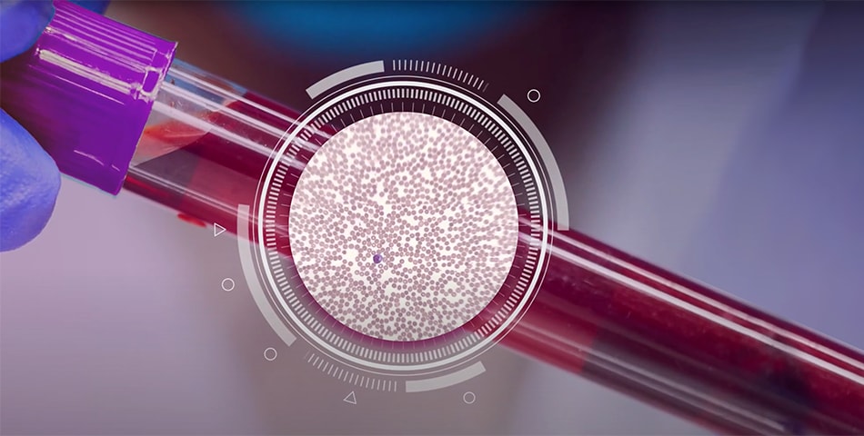 Explore the secrets of the feathered edge | Beckman Coulter