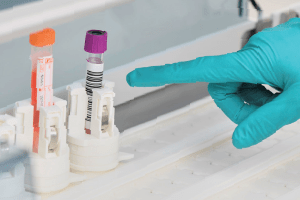 Intelligent Tube Routing in Lab Automation Can Improve Turnaround Times ...