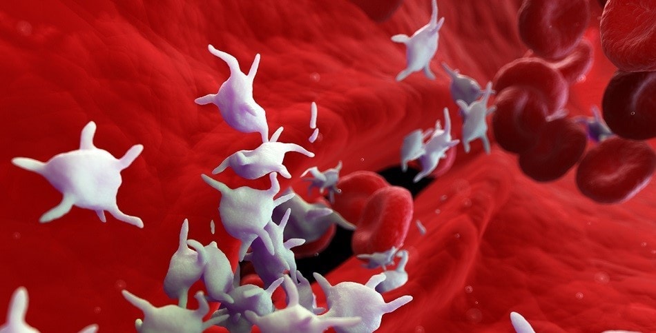 Mean Platelet Volume Parameter | Beckman Coulter