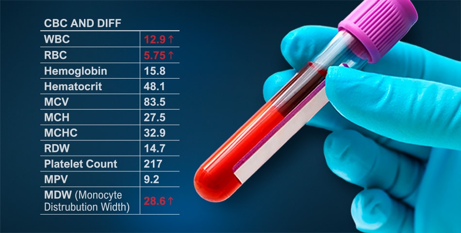 AMA recognizes MDW with PLA code | Beckman Coulter