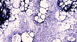 Beckman Coulter and Scopio Labs Add World’s First Digital Bone Marrow ...