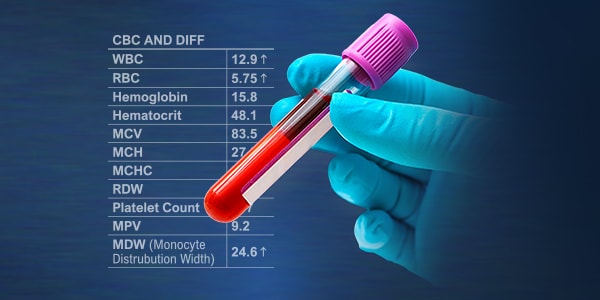 CBC-based sepsis screening tool with MDW | Beckman Coulter