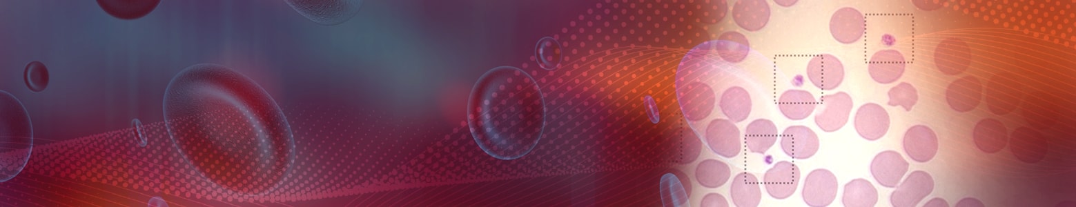 Compare platelet count for hematology analyzers | Beckman Coulter