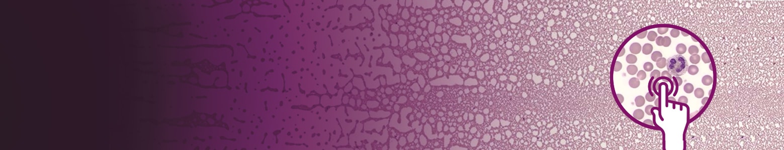 Remote Digital Microscopy | Beckman Coulter