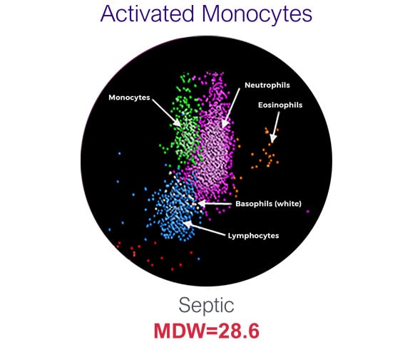 Monocyte Distribution Width Sepsis Marker | Beckman Coulter