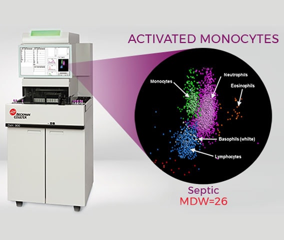 Monocyte Distribution Width Sepsis Marker | Beckman Coulter