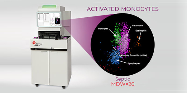 Early Detection and Treatment of Sepsis | Beckman Coulter Early Detection and Treatment of Sepsis | Beckman Coulter