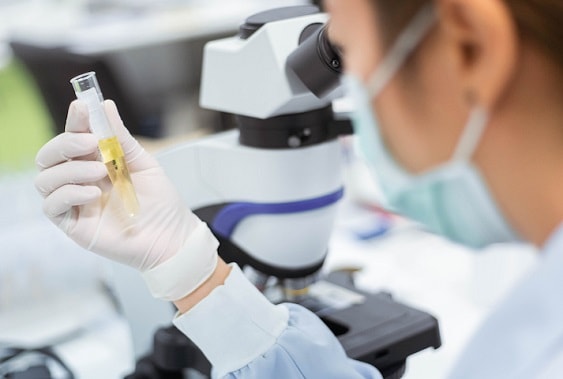 Beckman Coulter’s new urinalysis solution improves laboratory workflow ...