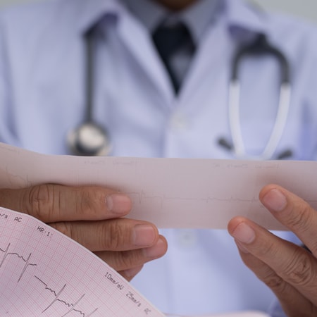 High-sensitivity Troponin Assay Access hsTnI | Beckman Coulter