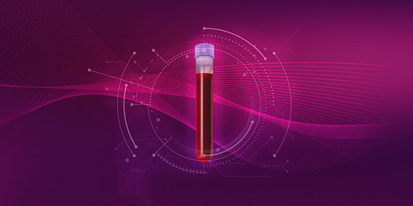 Digital Hematology | Beckman Coulter