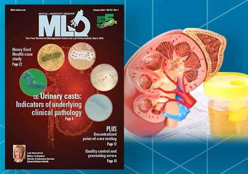 Automated Urinalysis Solution DxU Iris | Beckman Coulter